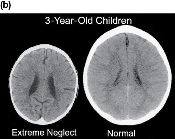4.3 Infants and Children Change Physically