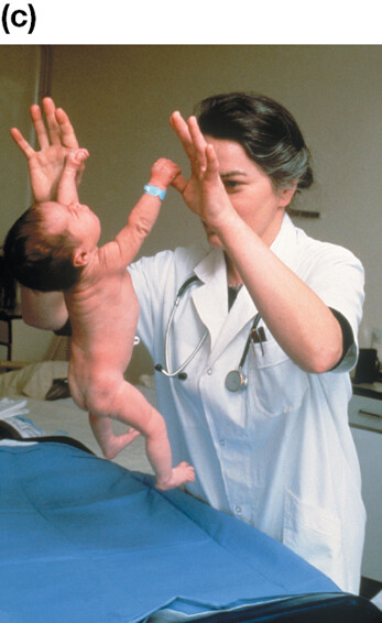 4.3 Infants and Children Change Physically